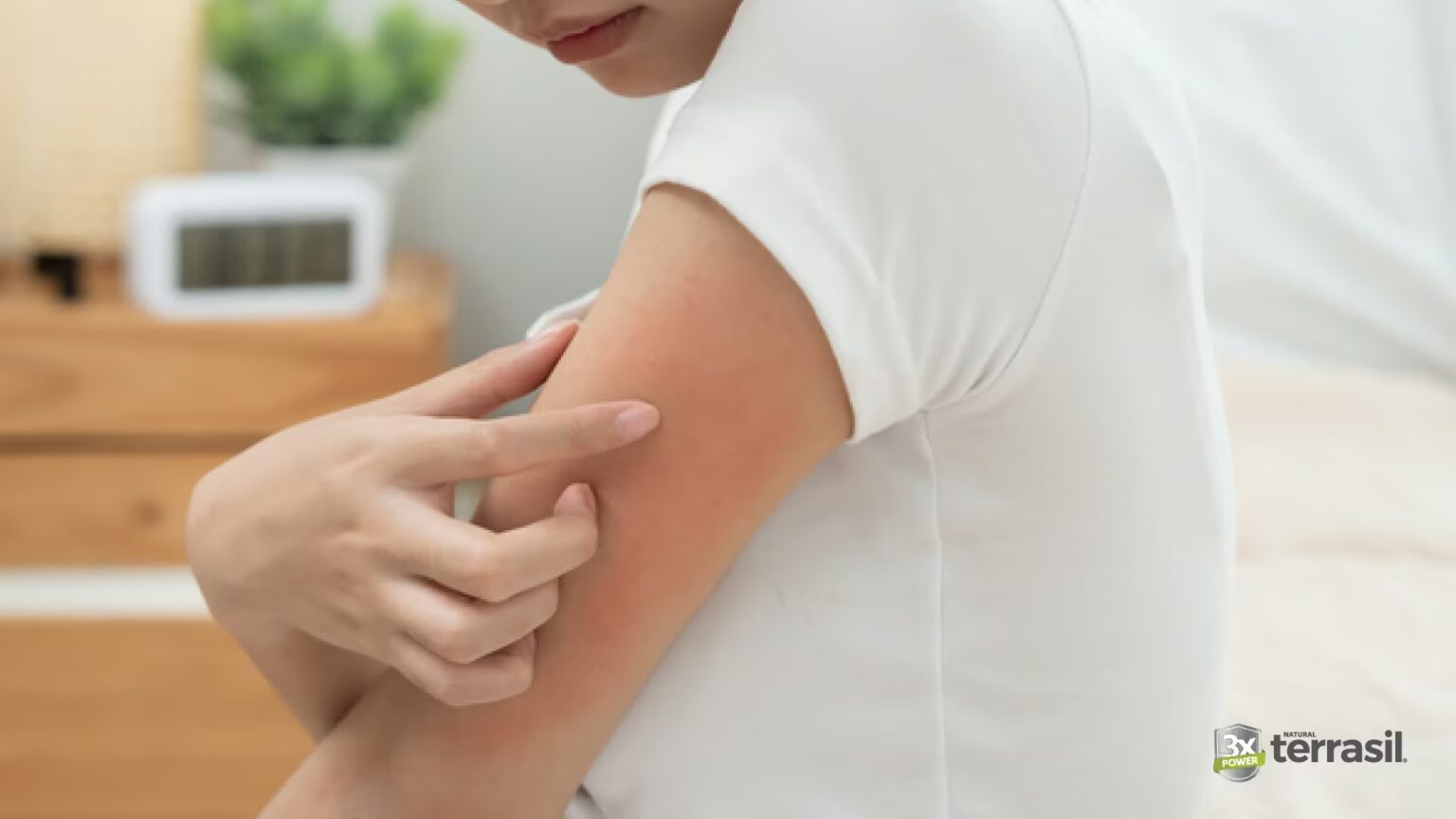 How to Identify and Treat Tinea Infections (Ringworm, Jock Itch & More ...